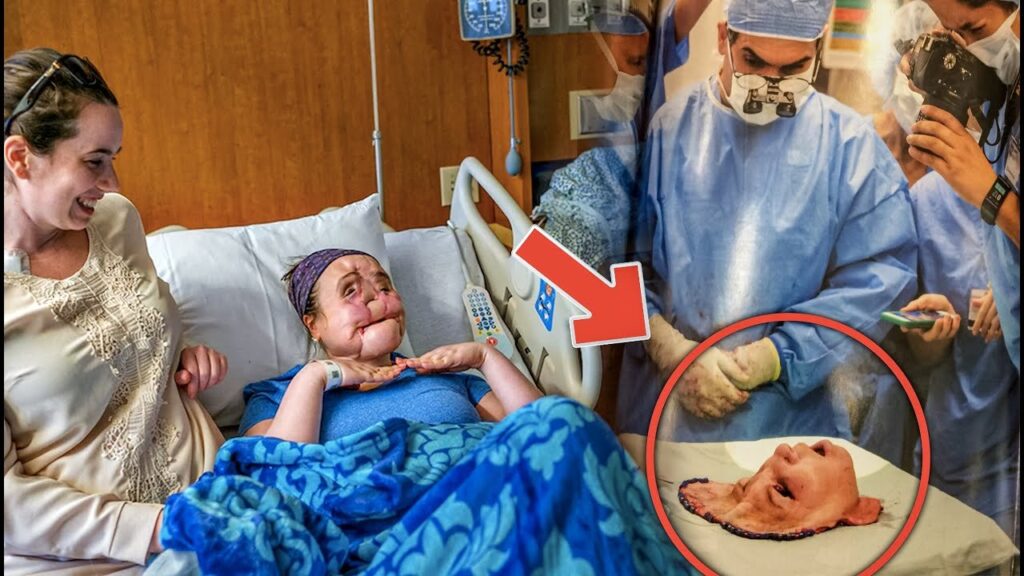 This Woman Had America’s First Face Transplant. Then Nine Years On She ...